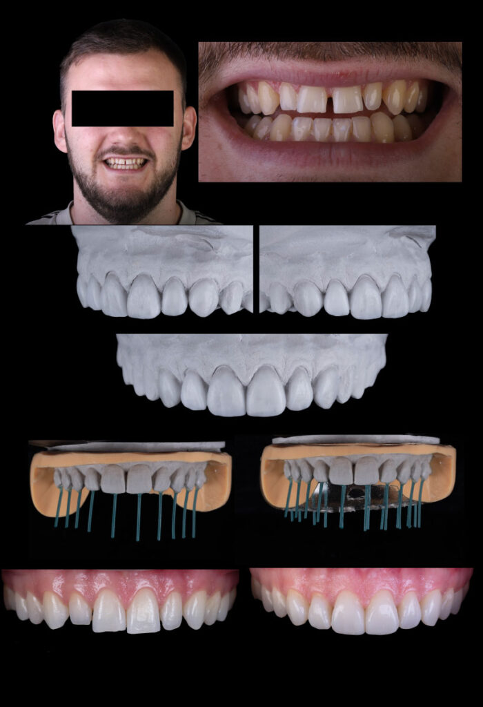 The Perfected Injection Moulding Technique - IPP