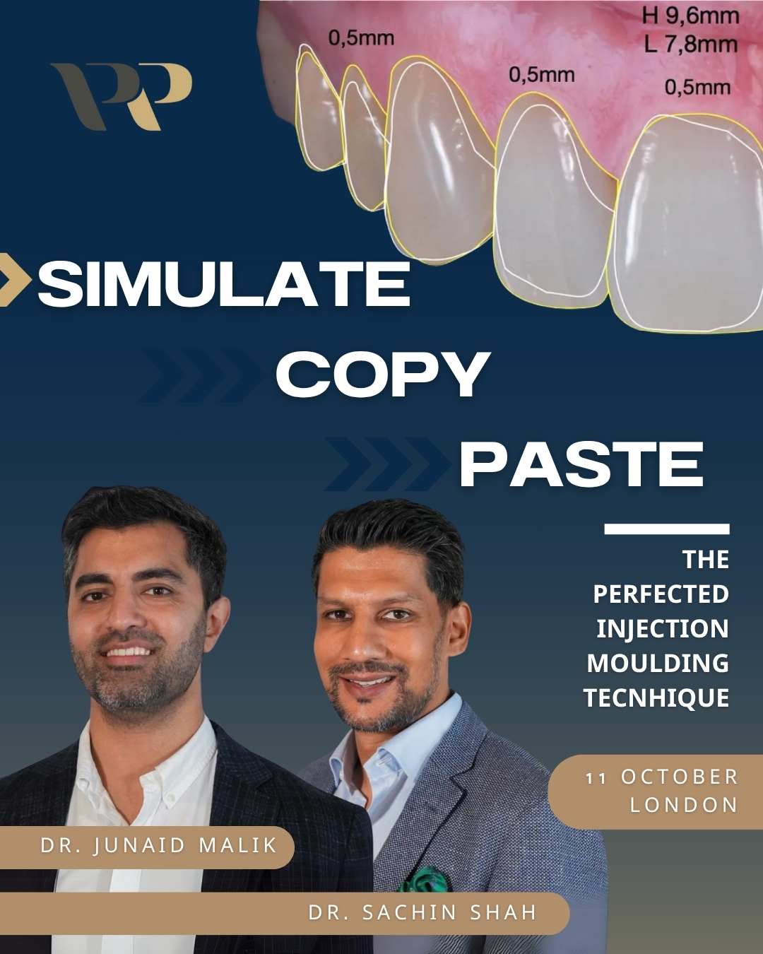 The Perfected Injection Moulding Technique - IPP