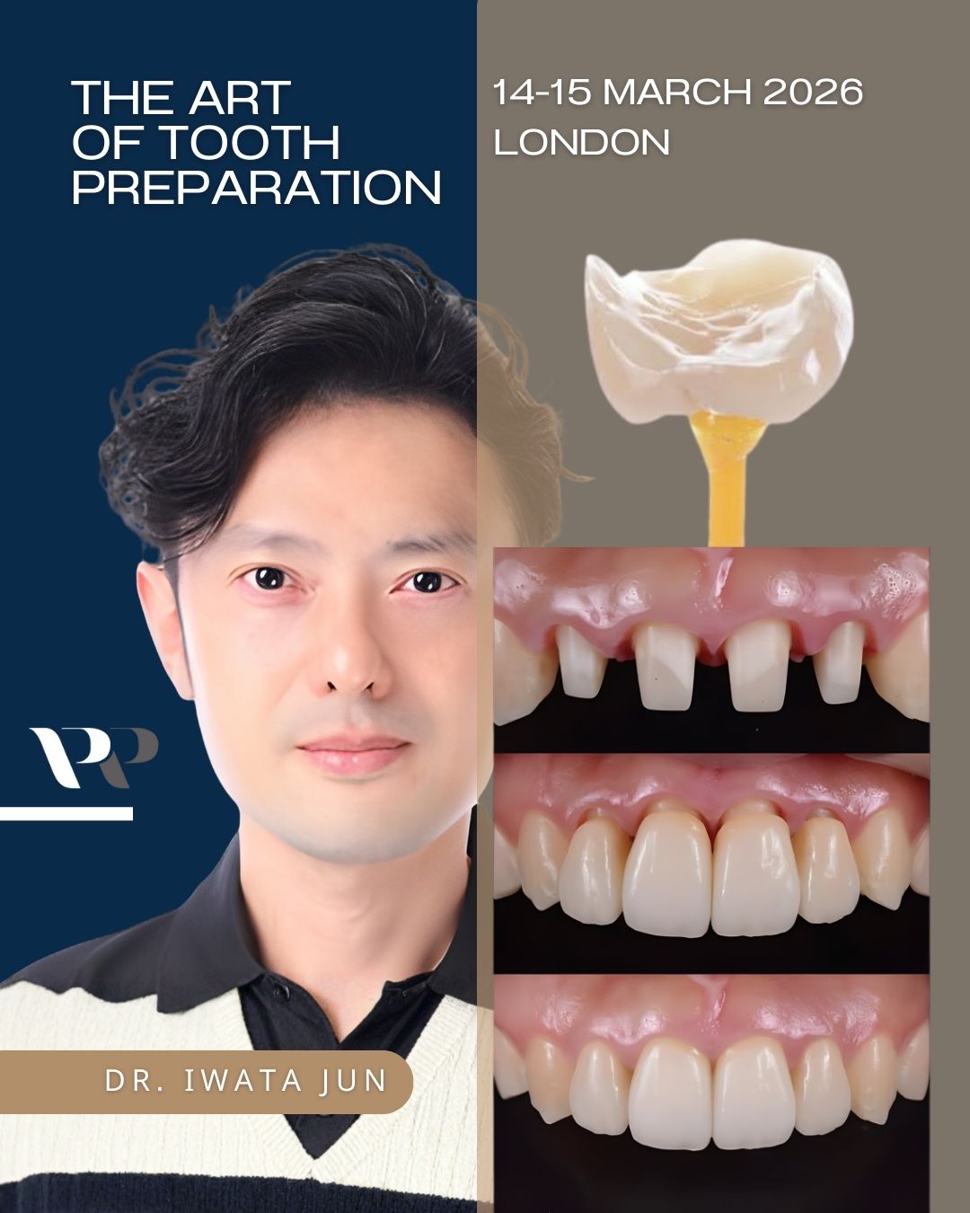 The Art of Tooth Preparation - IPP